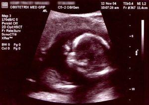 Engineering the Future: Breakthrough Embryo Editing Raises Ethical ...